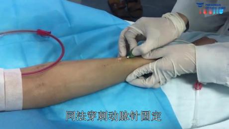 血液透析操作流程