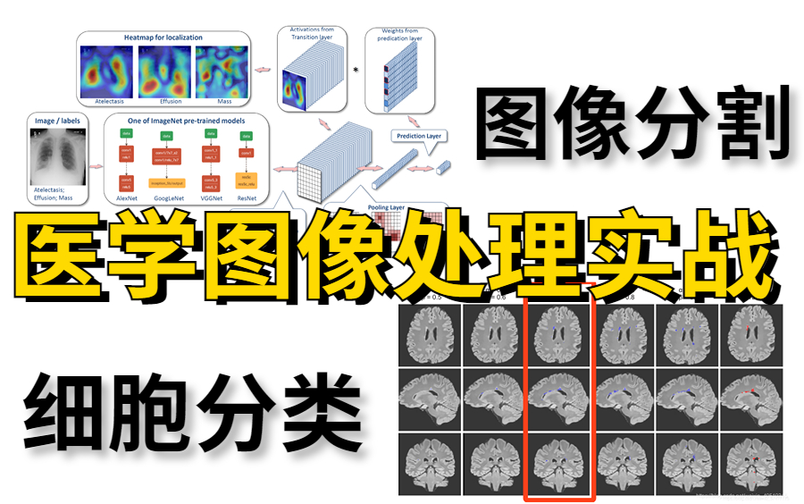 医学图像处理两大实战:【基于U-Net的图像分割】+【基于ResNet网络...