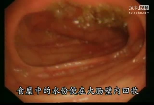 11-2-1尿液的形成