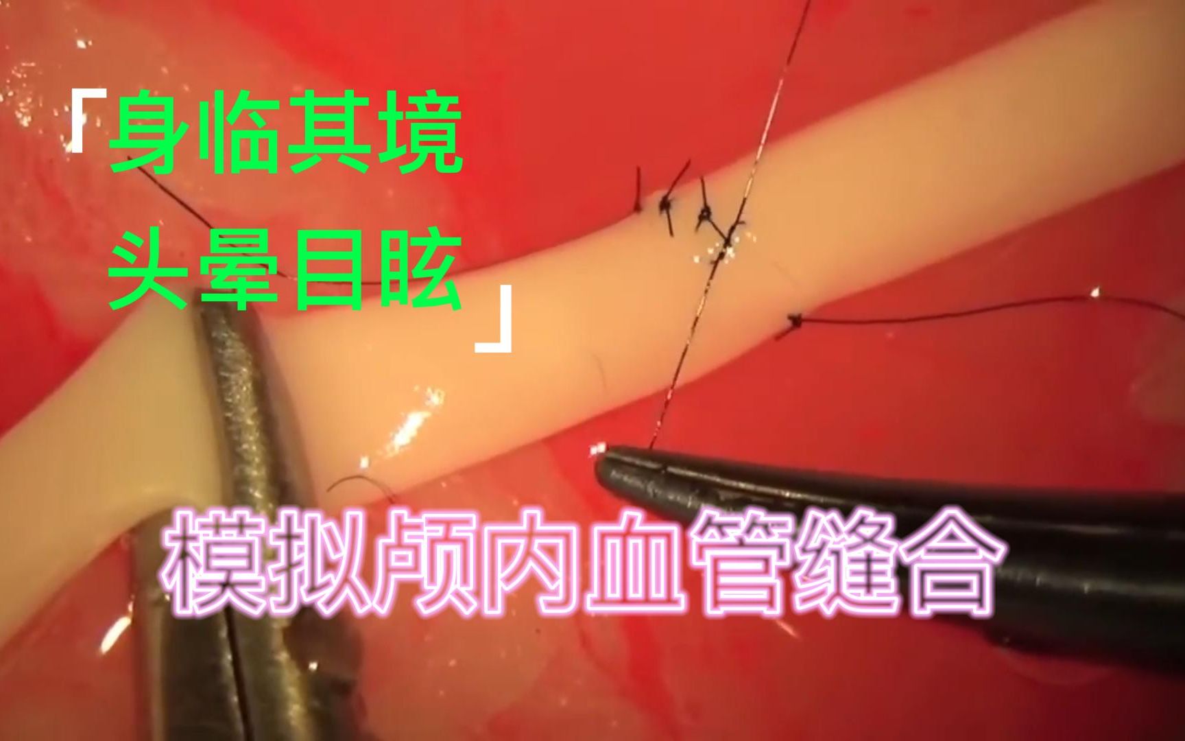 身临其境,头晕目眩,感受震撼 | 模拟颅内血管缝合