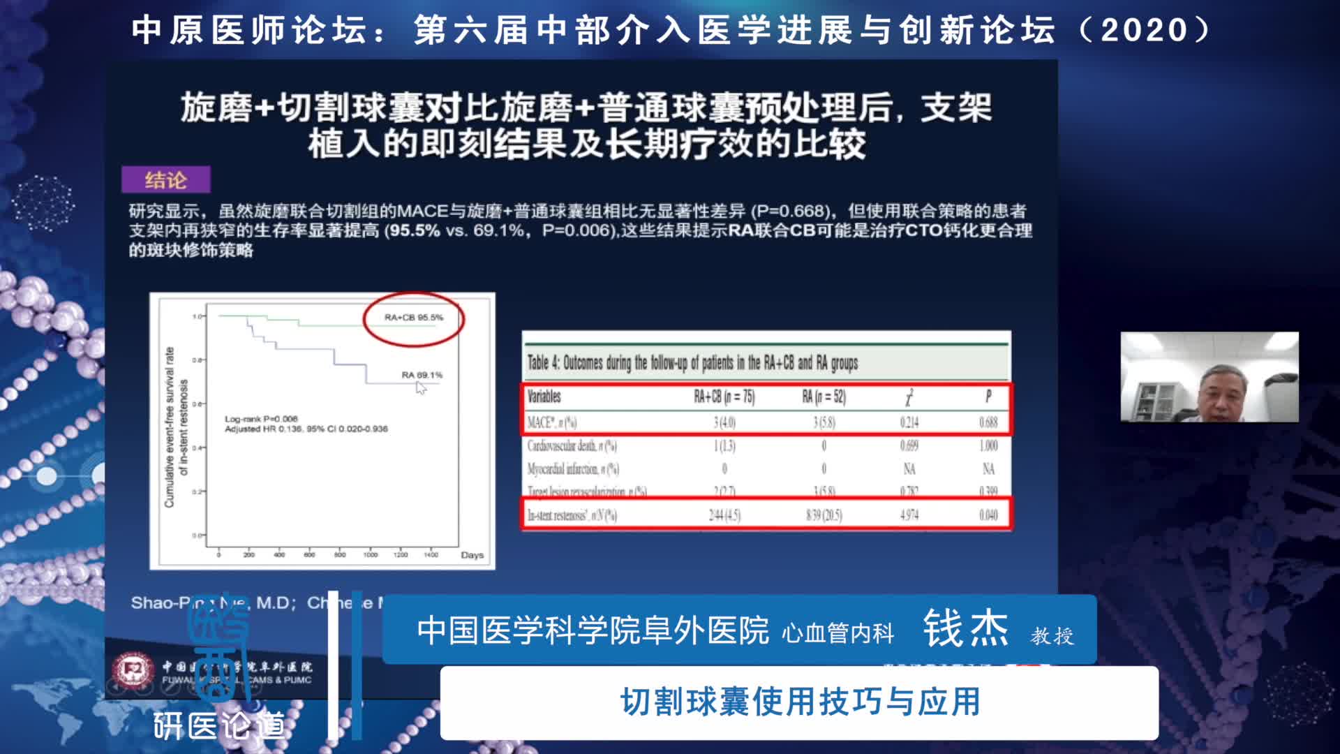 钱杰《切割球囊使用技巧与应用》