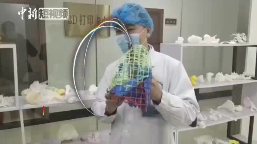 被新冠病毒感染的肺部是何样?3D打印模型为你立体还原