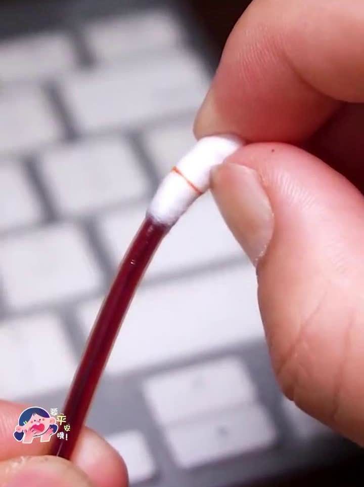 一到夏天老是会磕碰着腿、胯子,这个自带碘伏的棉签,就很好用 碘伏棉签