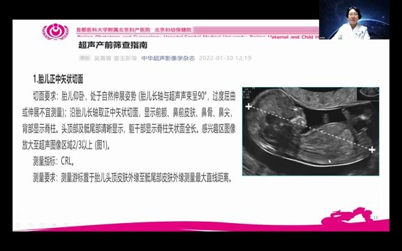 搬运 胎儿中枢神经系统异常产前诊断高峰论坛