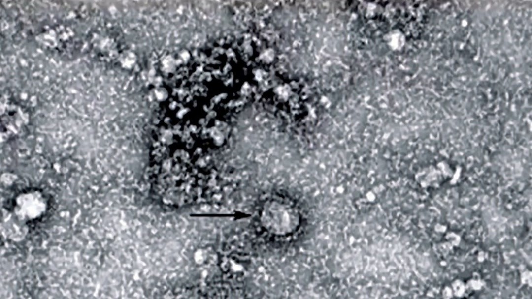 好消息!浙江成功分离到新型冠状病毒毒株!为科研人员点赞!加油!