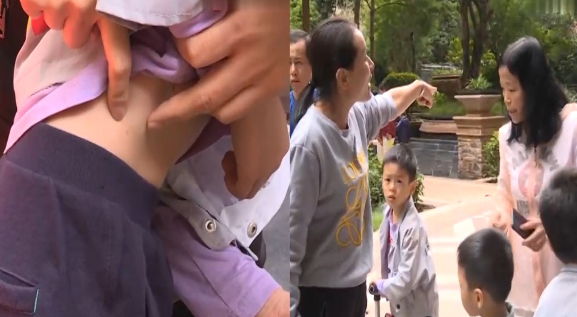 5岁男童被狗扑咬,狗主人的一句话让妈妈怒了:像蚊子叮了一下
