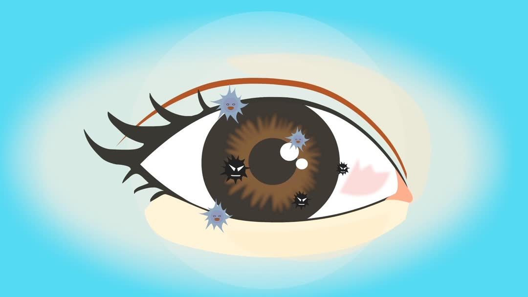细菌性结膜炎和病毒性结膜炎有什么不一样?眼科医生教你正确分辨