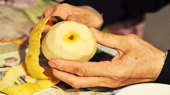 吃水果要削皮,有一点要谨记,否则吃水果也会让你感染寄生虫病