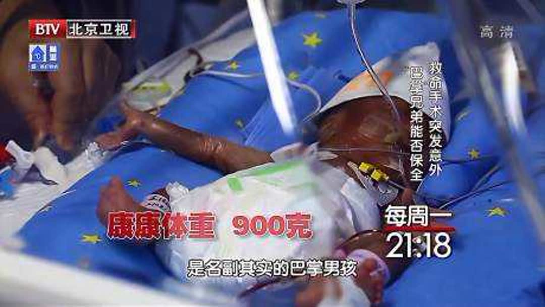 “巴掌”婴儿开胸手术,术中却发生了意外,医生会如何处理?