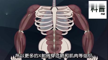 X射线的原理和应用