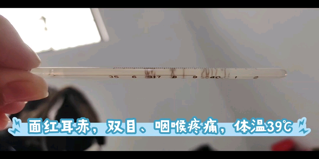 中医外治合麻黄汤治疗新冠阳性发热、面红耳赤、双目及咽喉疼痛病案