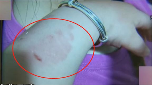太气人!孩子被别人家孩子咬伤,店家强调不是会员?