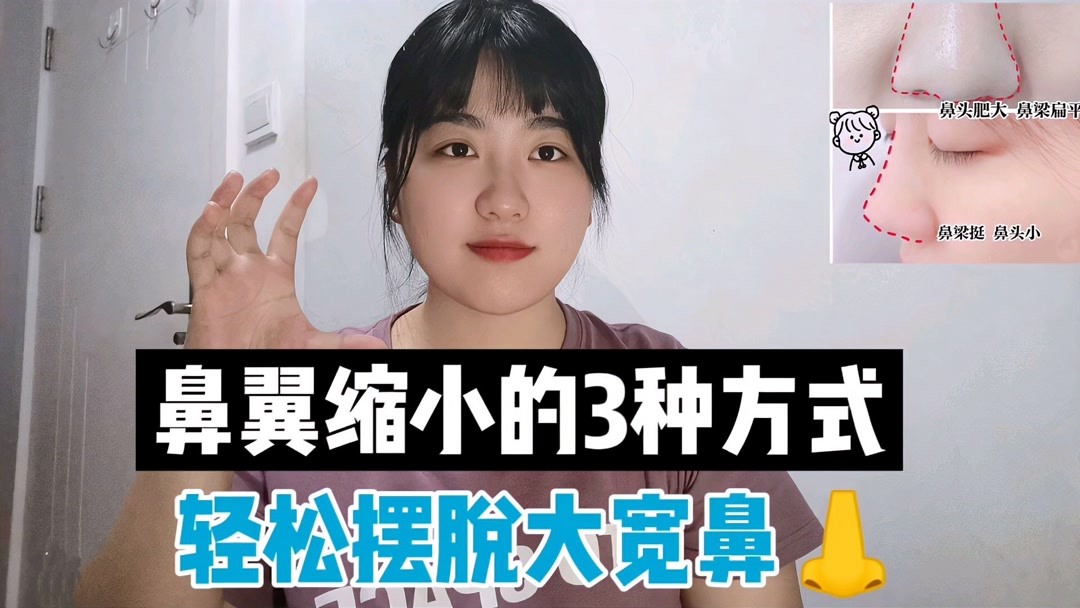 鼻翼缩小的3种方式,轻松摆脱大宽鼻