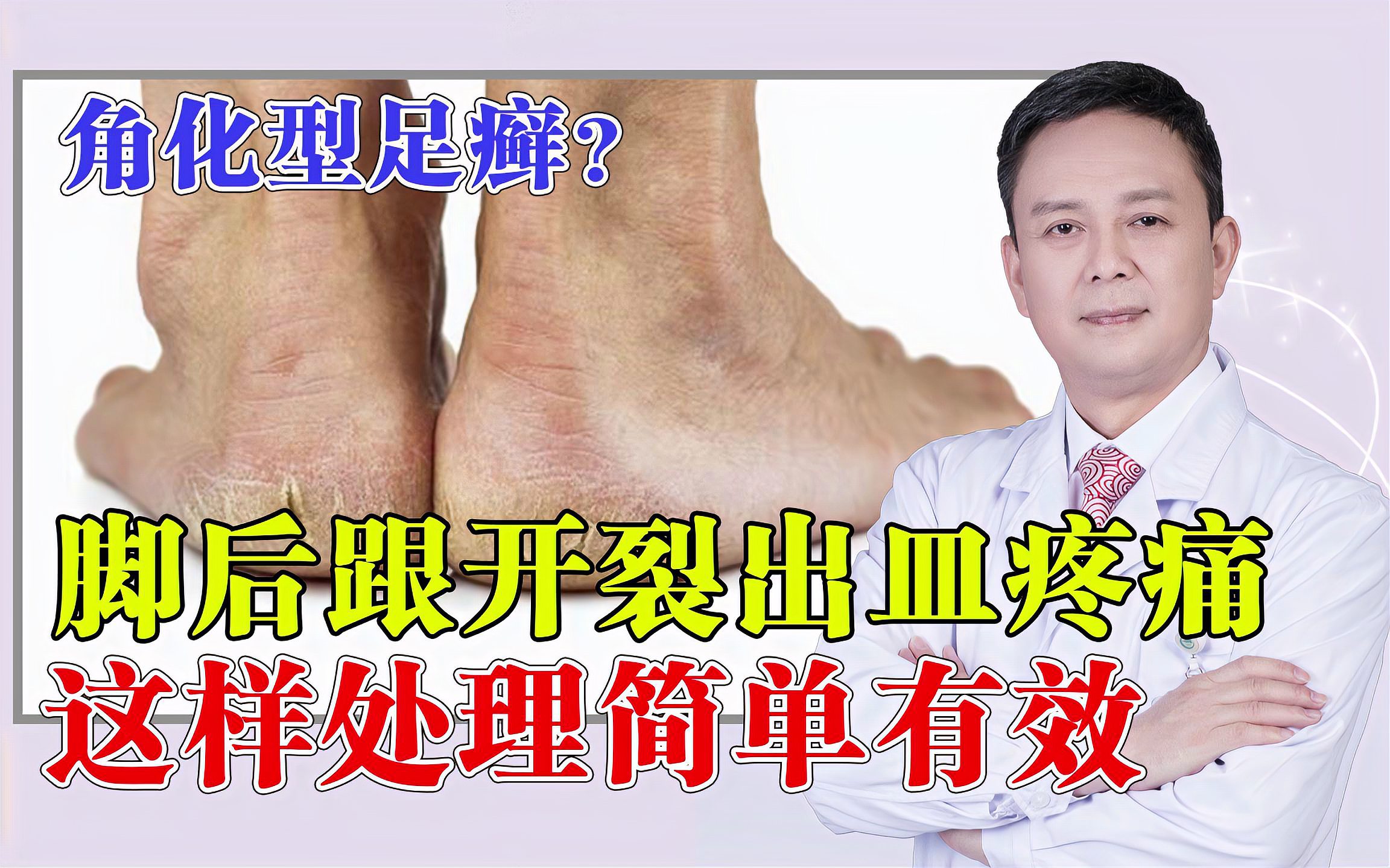 脚后跟开裂出血疼痛,这样处理简单有效。
