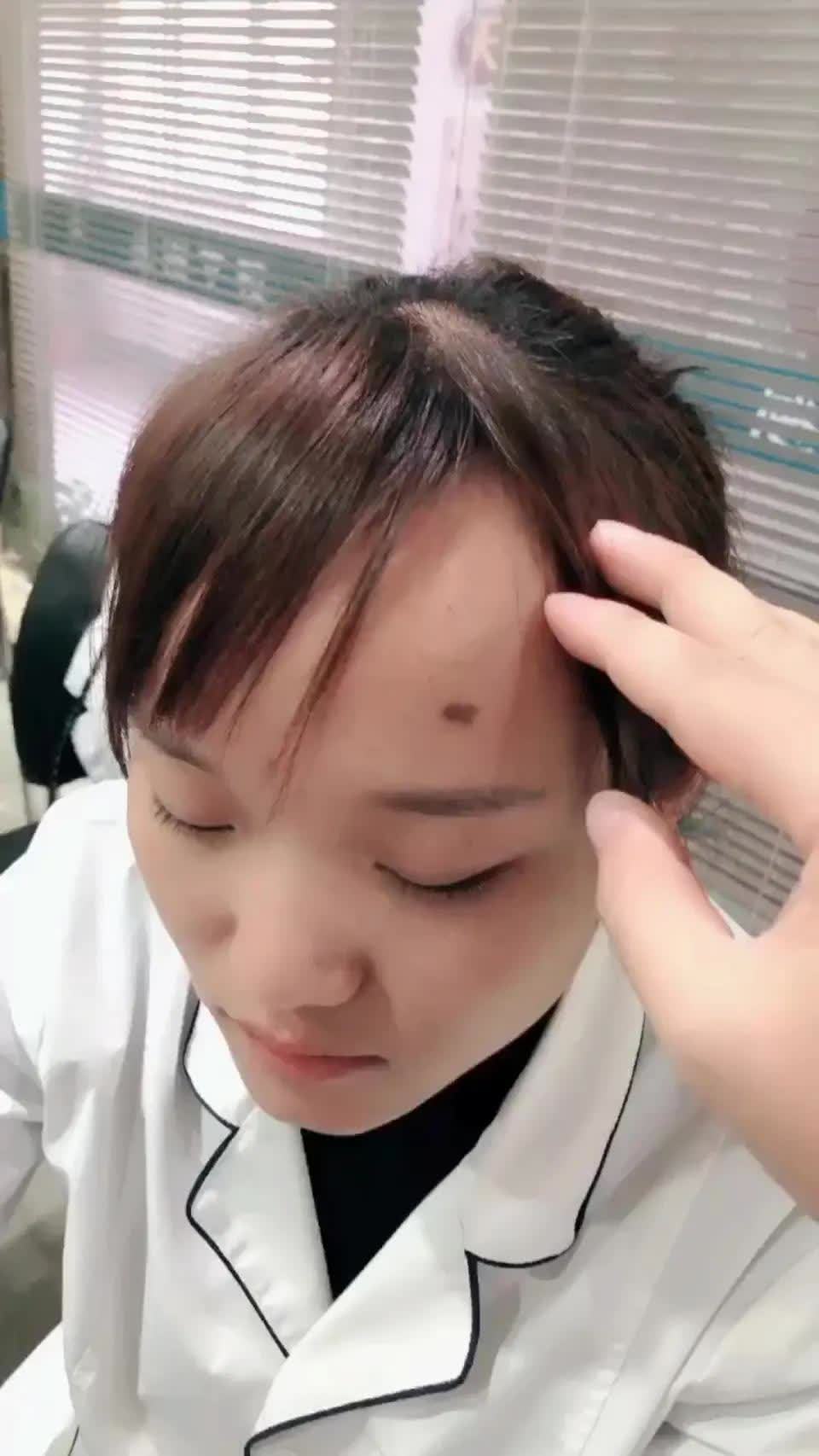 .眼皮总想下垂,严重影响我的盛世容颜怎么办?试一下点按阳白穴