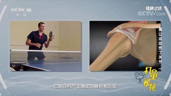 为什么肩关节在运动过程中容易受伤?一段动画清晰演示|健康之路