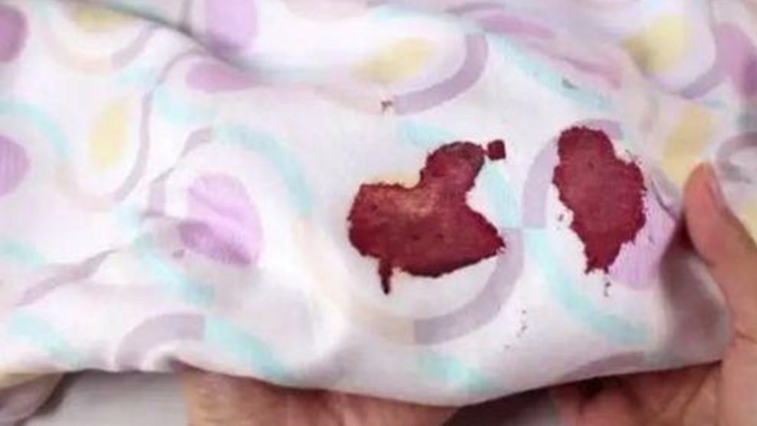 床单上有血迹不用愁,教你正确方法,新老血渍全去除,简单又实用