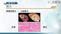 第一章 细胞、组织的适应和损伤 第一节 细胞和组织的适应 2.肥大、增生