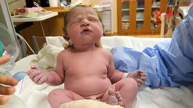 实拍宝宝出生全过程,当婴儿降生的那一刻,爸爸激动不已!