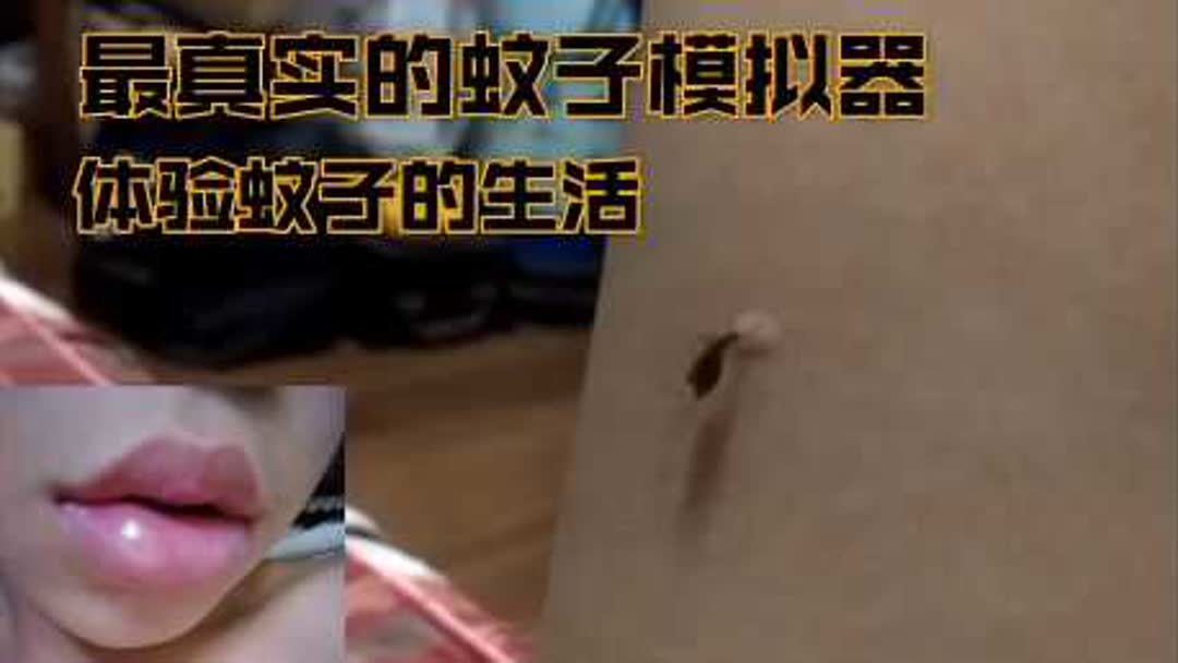 最真实的蚊子模拟器,一叮一个包凶得很,小姐姐表示受不了