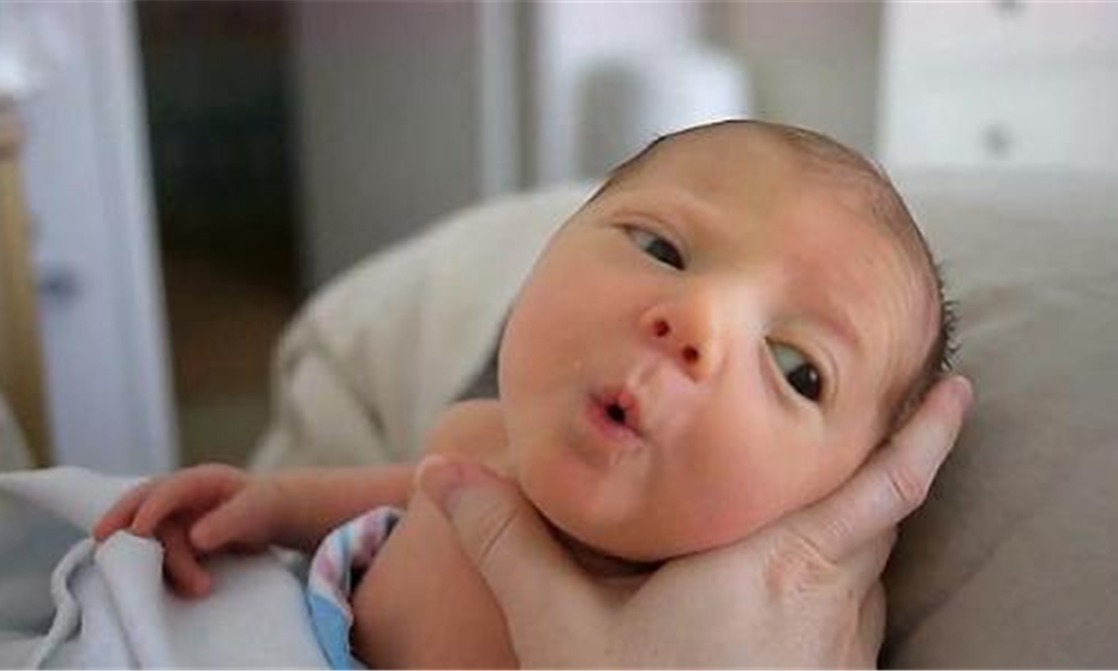 天生没大脑的人能活下去吗?医生建议安乐死,两年后奇迹却发生了