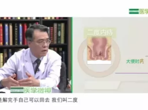 痔疮都有哪些类型?