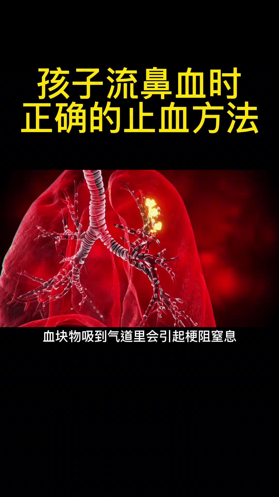 孩子流鼻血的正确止血方法