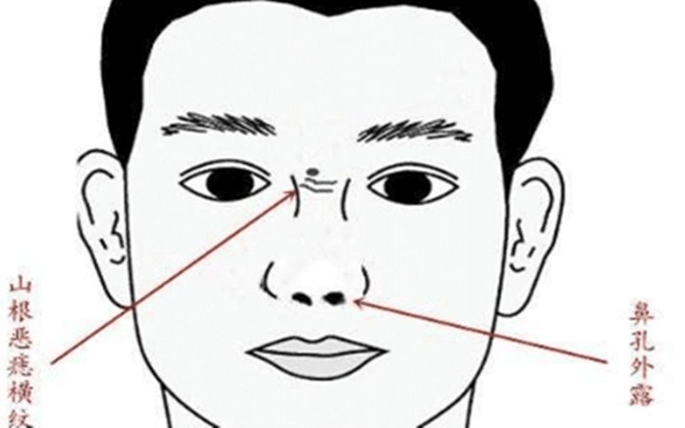 教你察言观色辩心病,快拿镜子对照下山根处有横纹说明心脏有问题