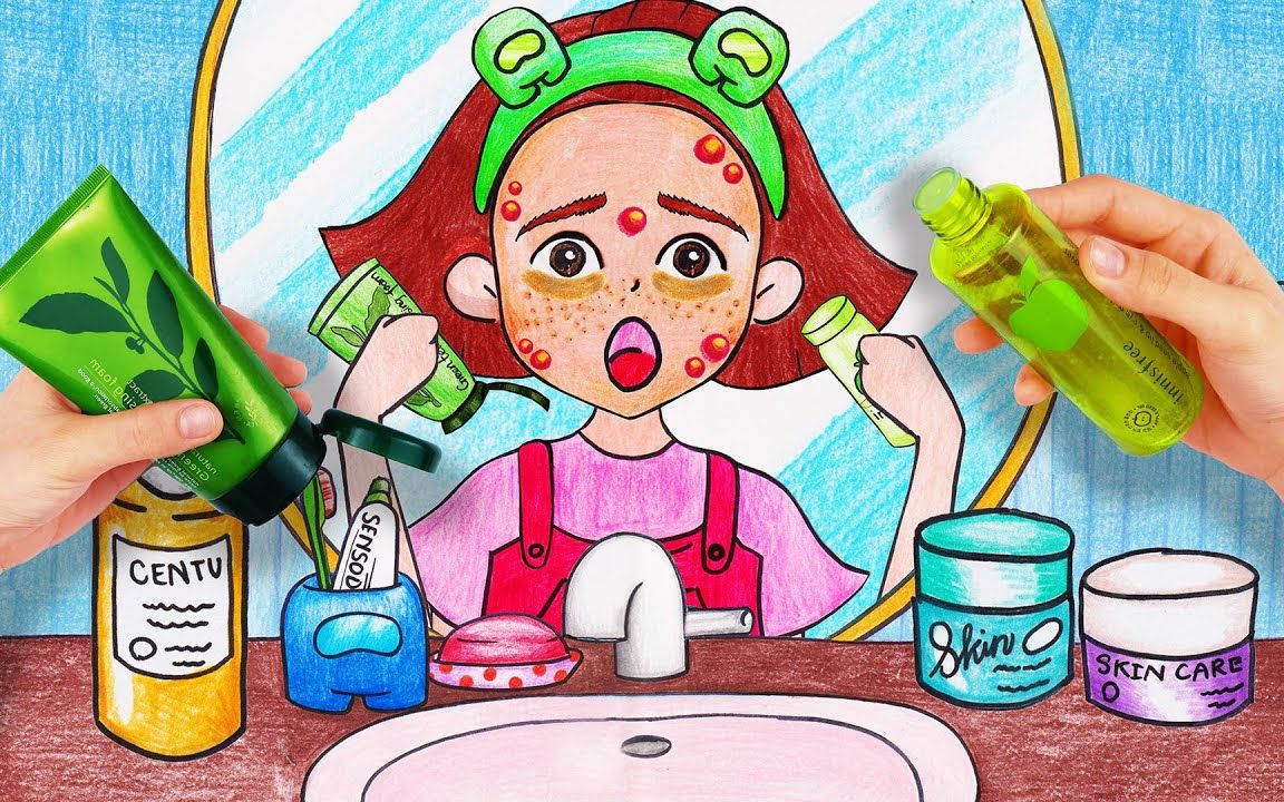 定格动画:小红长痤疮了,看看她是怎么消灭痤疮的