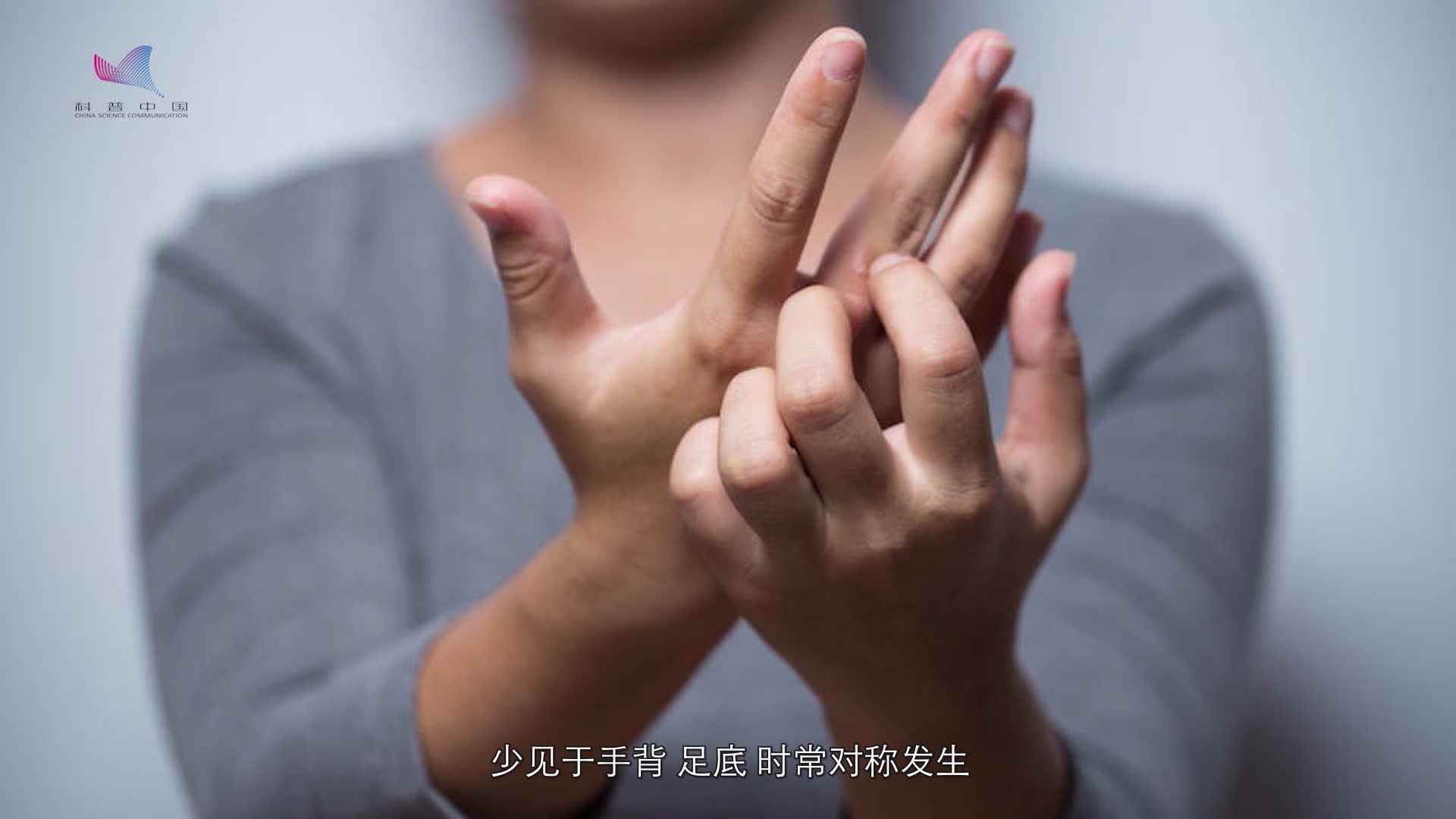 手脱皮可由多种原因引起 对症下药才有效
