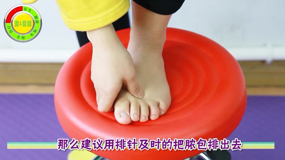 脸上长痘痘泻火排毒,只需按脚上1个穴位,5分钟即可!