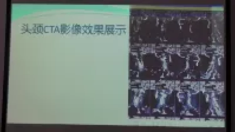 头颈部CTA的原理及操作20180419