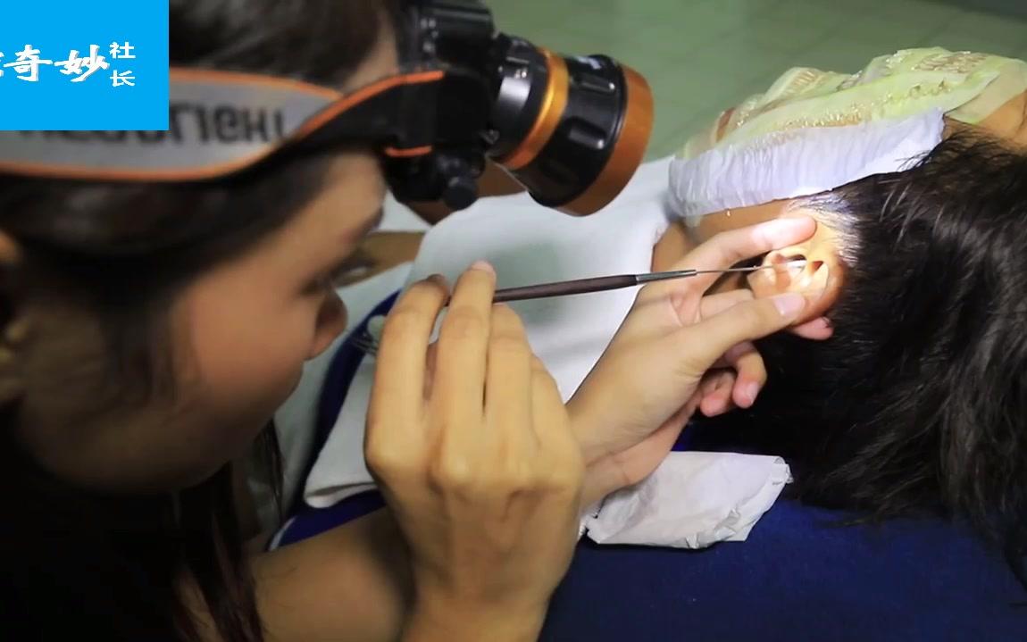 视觉ASMR 越南按摩 采耳 掏耳朵 CUT6