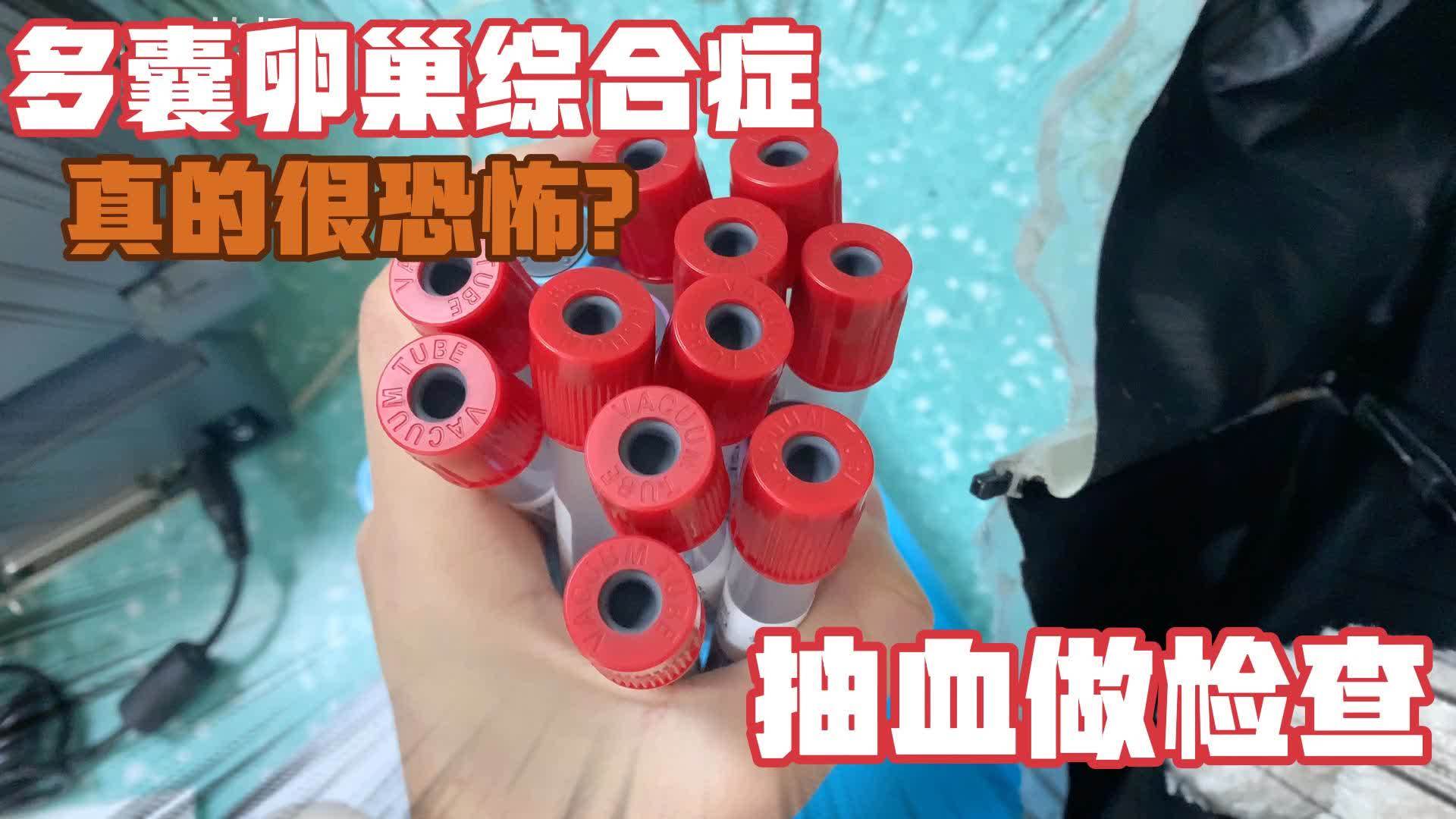 珊珊:微胖的珊珊 十年经期不准,心惊胆战做备孕检查,医生:不要自己吓...