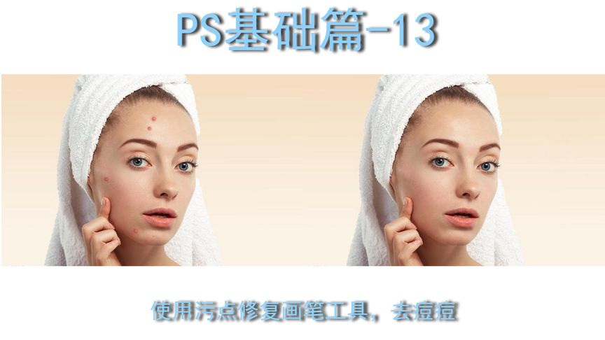PS基础篇—13,使用污点修复画笔工具去痘痘