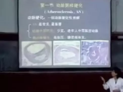 心血管系统疾病1.2