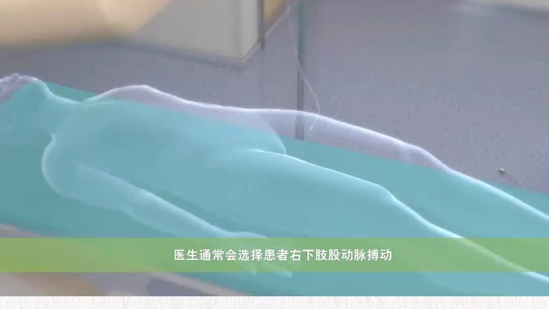 神经外科动画科普之脑血管造影技术【医疗科普】