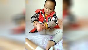 农村残疾宝宝小腿截肢,给自己穿假肢让人心疼,我已经止不住流泪