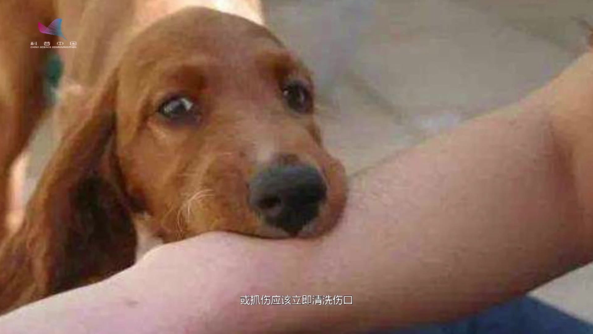 被疯狗咬用嘴吸伤口会得狂犬病吗?