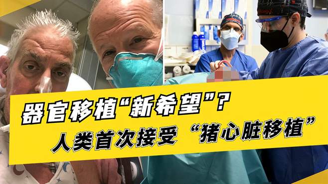 美国男子“猪心脏移植”:系全球首例,或将开启移植“新大门”?