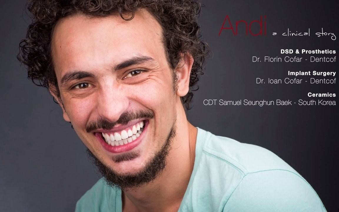 【修复】数字微笑设计(DSD)——临床全流程操作速览