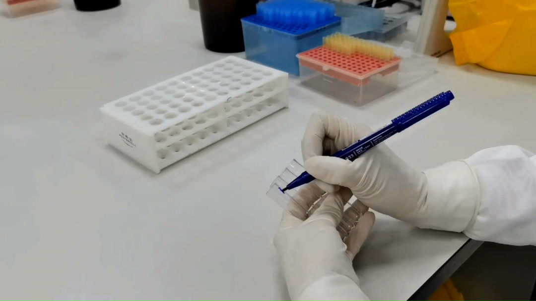 新生儿ABO溶血病血清学检测操作——昆明市儿童医