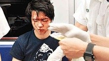 癫痫病的发作 头部外伤易导致