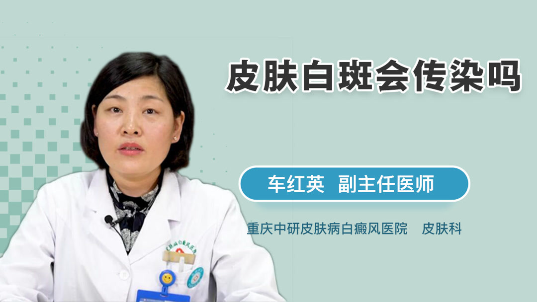 皮肤白斑会传染吗