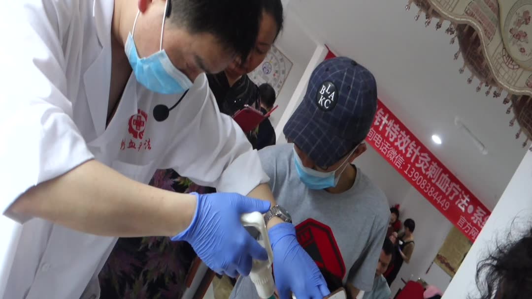 放血拔罐疗法视频