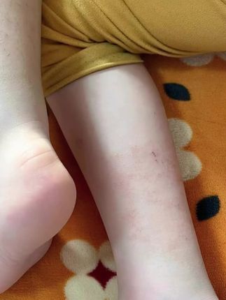 热门秋冬天气干燥,宝宝皮肤娇嫩需要呵护凡士林金盏花润肤乳