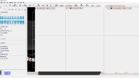 GuideMia 正畸培训 5-基于CBCT或CT数据提取上颌牙体模型.mp4