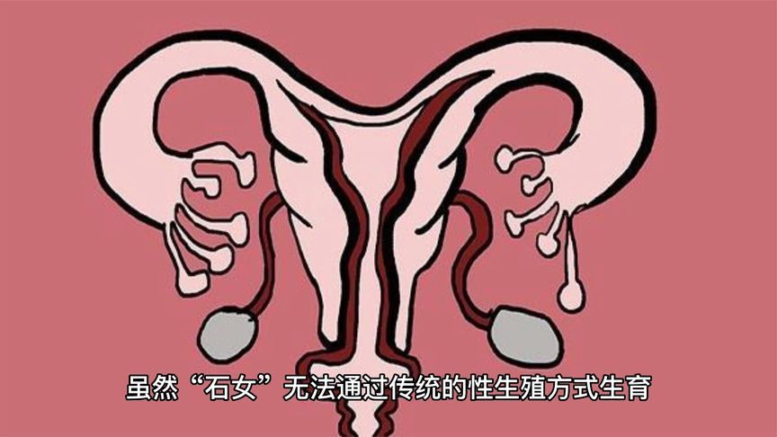 什么是"石女"?她们和正常人有什么区别?"石女"还能生育吗