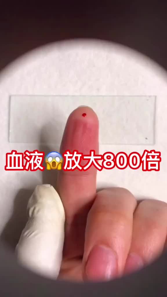 162_显微镜下的血液竟然是这样哇塞