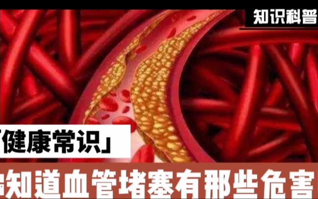 你晓不晓得血管堵塞有哪些危害呢?舒棋与你一起了解血管堵塞有那些...